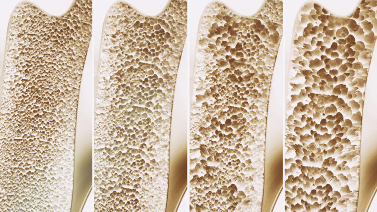 If You Cycle a Lot You Are Going to Get Bone and Muscle Loss